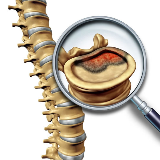 Dr Omar Cirurgia Da Coluna Em Maring 